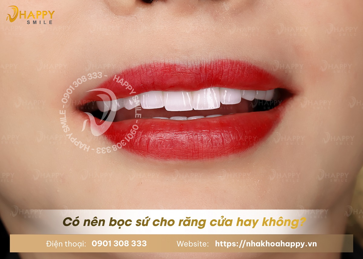 Răng thỏ là gì ? Dáng răng thỏ đẹp cho nụ cười duyên dáng và thu hút ...