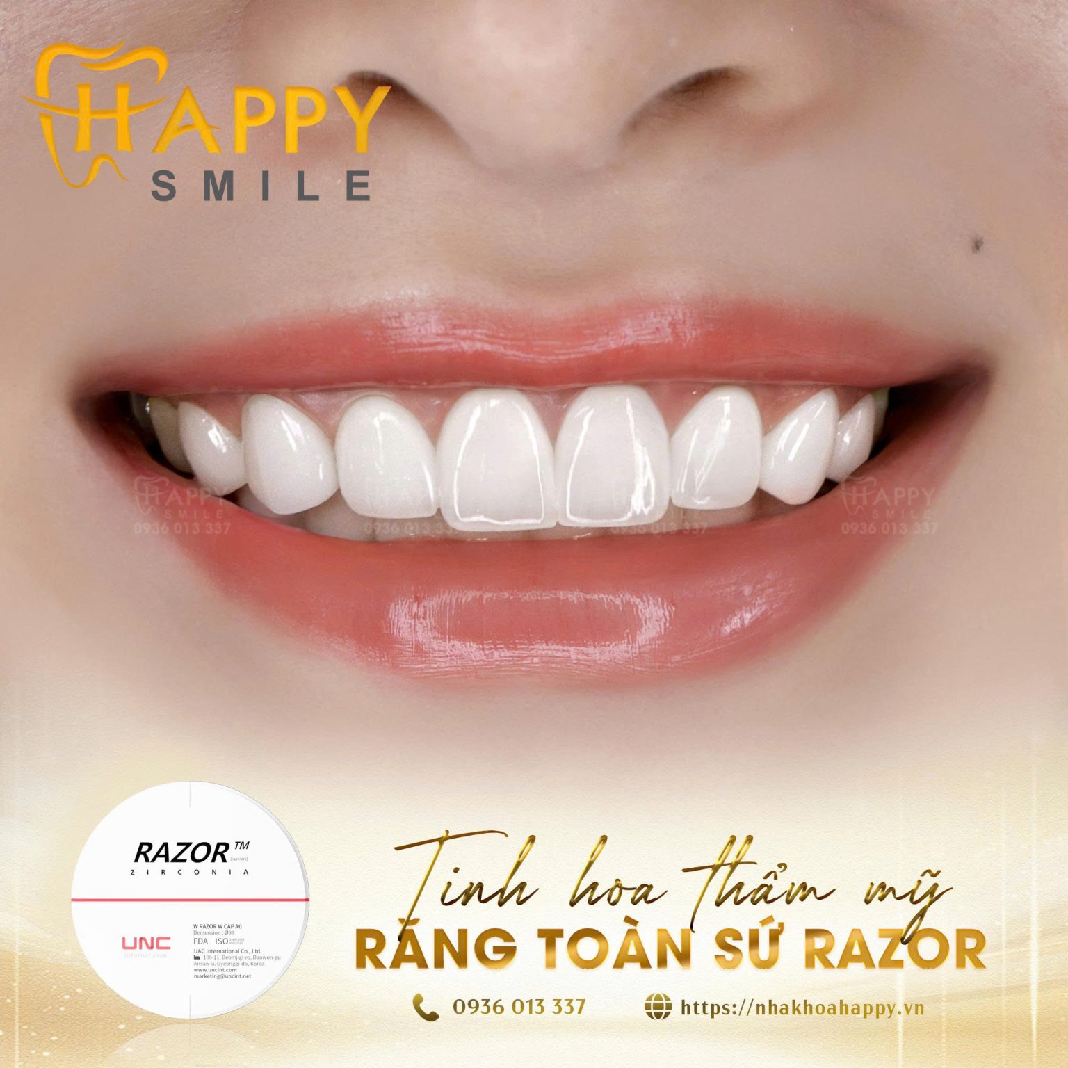 Răng sứ Razor là gì? Răng sứ Razor có tốt hay không? - Nha Khoa Happy Smile